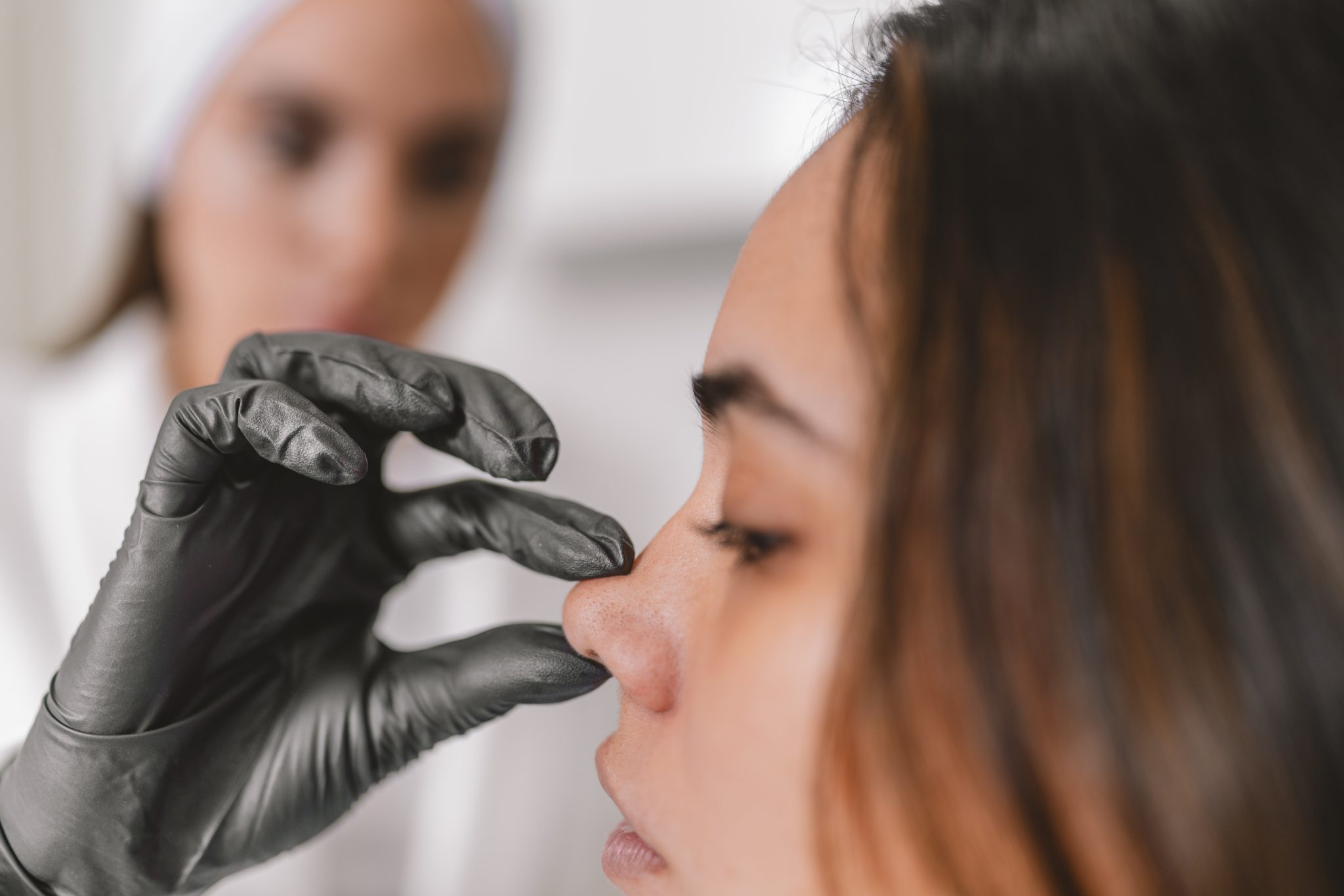 Cómo corregir la giba nasal con rinoplastia: soluciones seguras y efectivas
