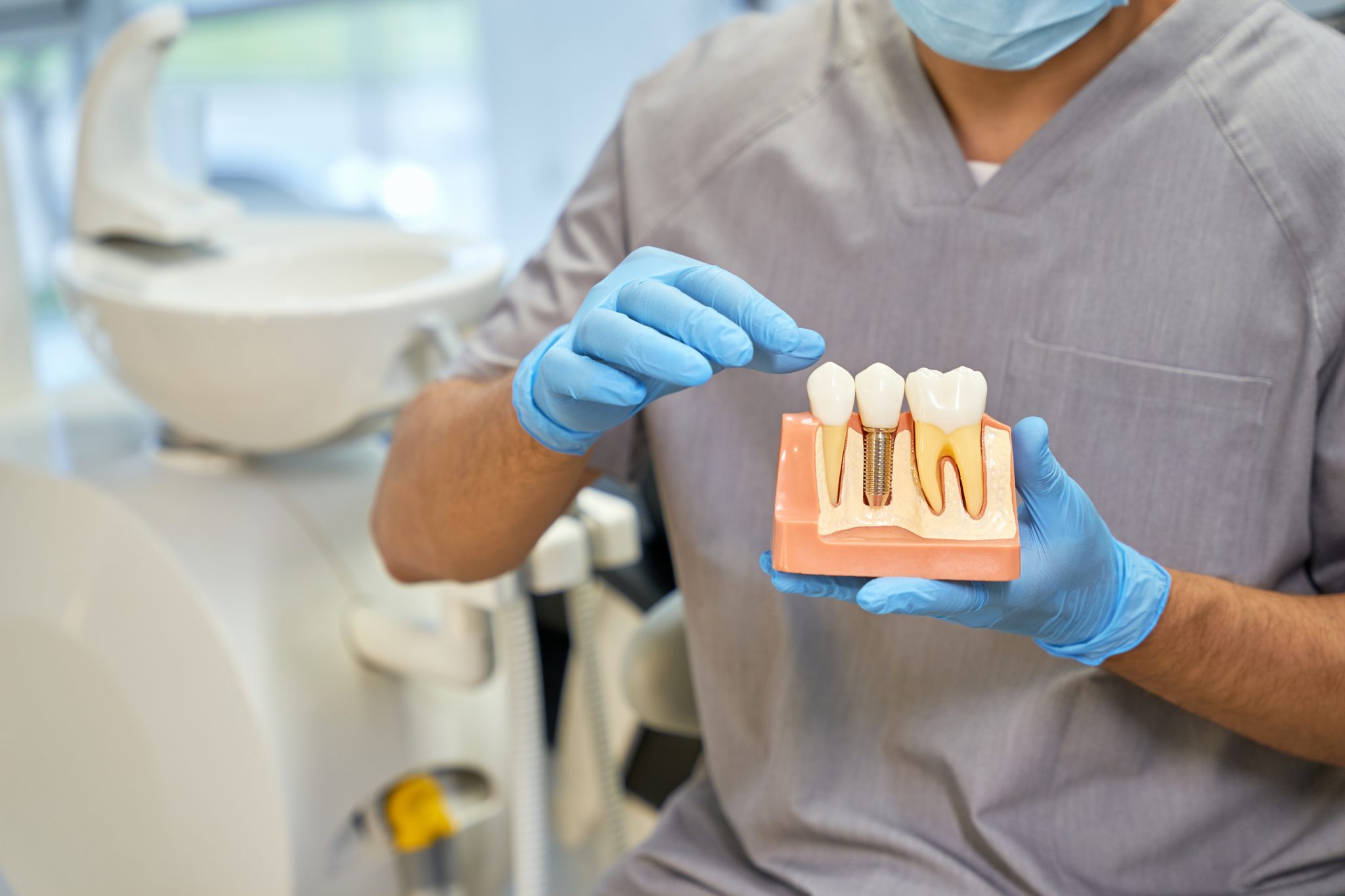 Cómo corregir la giba nasal con rinoplastia: soluciones seguras y efectivas